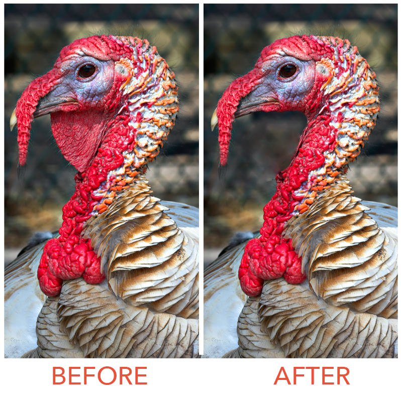 Non-Invasive Treatments For "Turkey Neck"