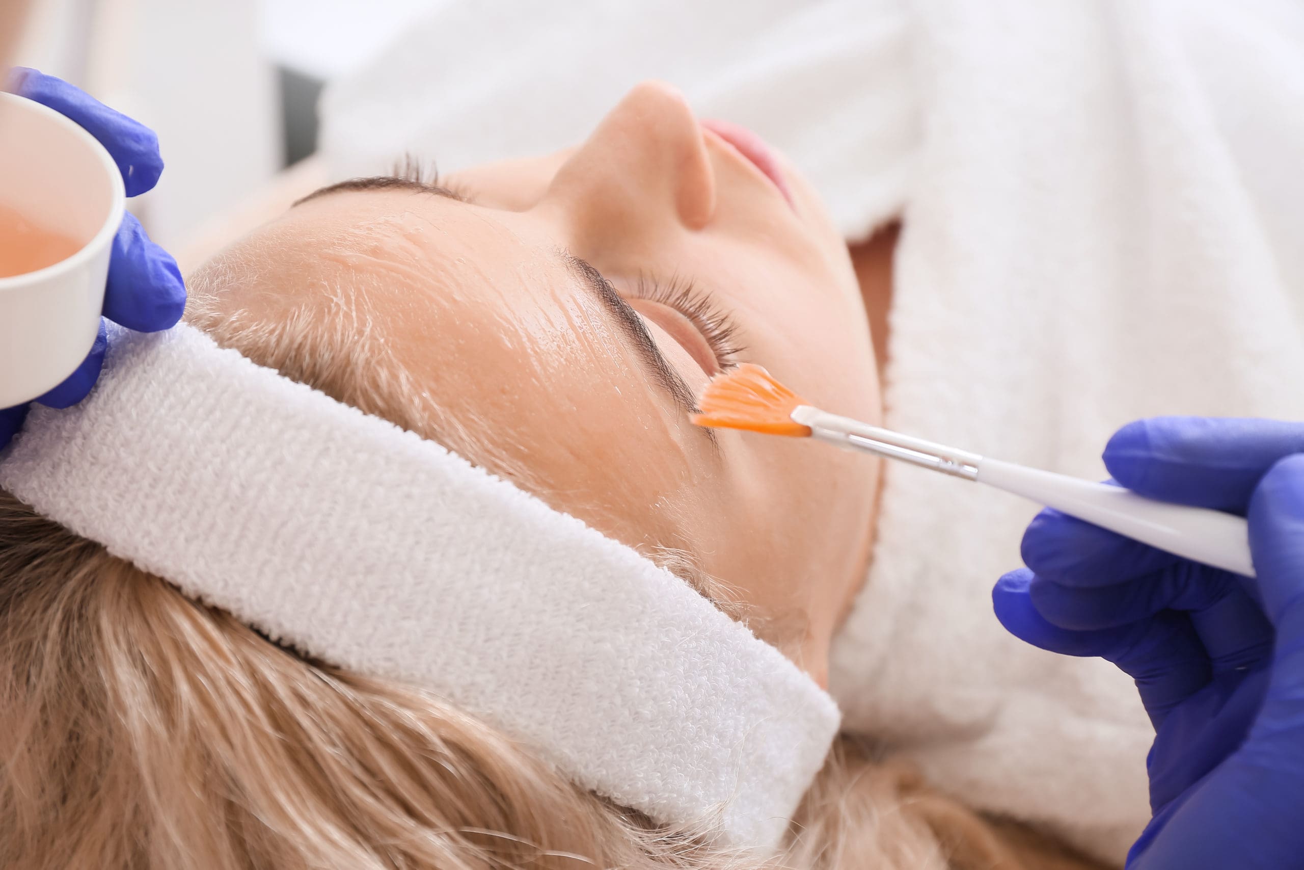 What Are Chemical Peels Used For?